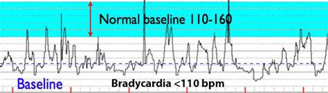 Normal Fetal Heart Rate Chart