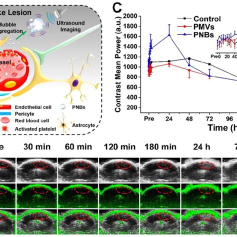 Stroke Real Time Contrast Enhanced Ultrasound Imaging A Schematic Download Scientific