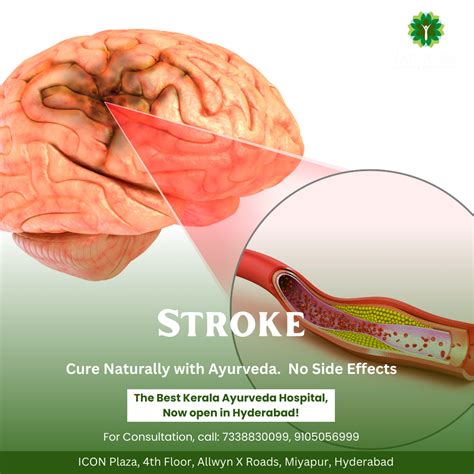 Understanding Stroke Causes Symptoms And Prevention Mayura Hospitals