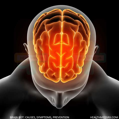 Brain Rot Causes Symptoms Prevention And Remedies Ultimate Guide