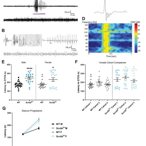 Eeg Abnormalities And Altered Susceptibility To Induced Seizures In Download Scientific Diagram