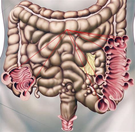 Entzündungen Symptome Ursachen And Behandlung Welt