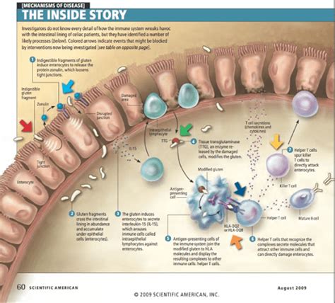 Zonulin And Leaky Gut