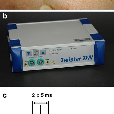 Transcorneal Electrical Stimulation Was Performed Using A A Sterile Download Scientific Diagram