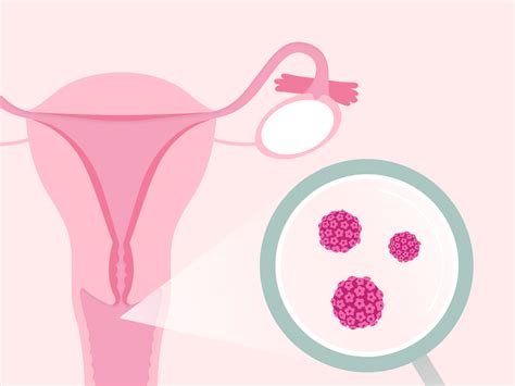 Abnormal Pap Test Should You Worry