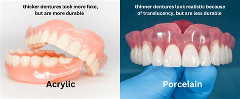Denture Vs Implant Prices Ultimate Full Row Replacement Guide