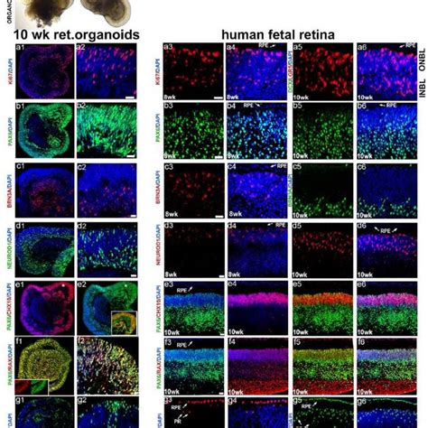 Gene Expression Cluster Analysis Of Early Human Retinal Organoids Wk Download Scientific