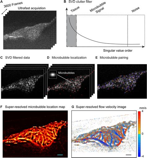 Microbubble Localization And Tracking A Iq Data 3600 Frames Was Download Scientific