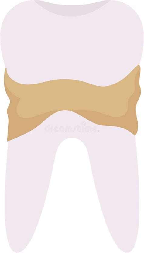 Calculus Tooth Problem Stock Vector Illustration Of Teeth 285676382