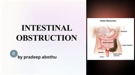 Intestinal Obstruction Pptxjkkhhhhhjjkjy Pptx