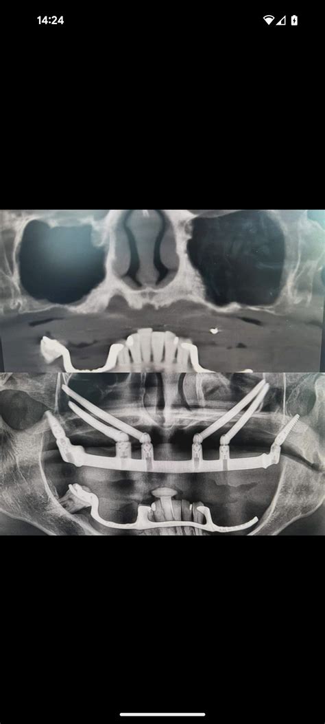 Simran Chaggar Posted On Linkedin