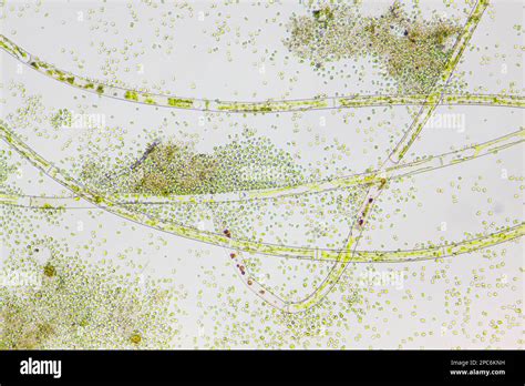 Hair Algae Microscope At Melvin Murillo Blog