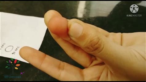 Bleeding Time ⏱ By Dukes Method Youtube