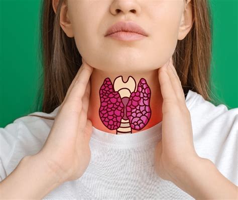 Top 4 Reasons To Worry About Thyroid Nodules