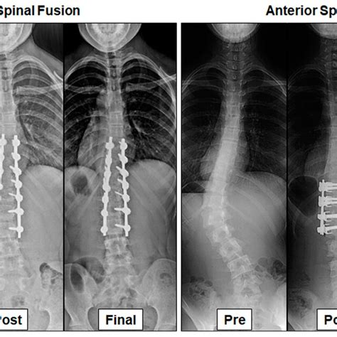 Receiver Operating Characteristic Roc Curve Of The Preoperative Download Scientific Diagram