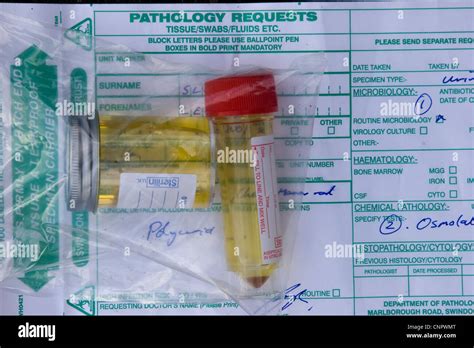 Sample Bottles Used In Chemical Pathology At Roberta York Blog