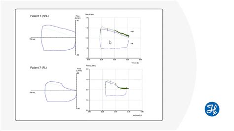 Journal Club Manual Compression Of Abdomen To Assess Expiratory Flow