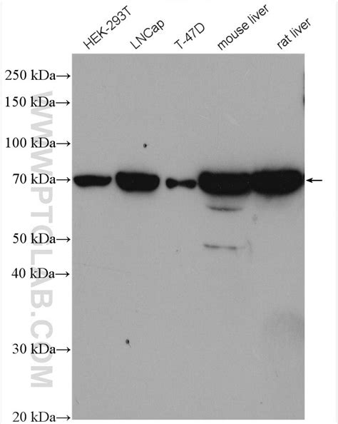 Cpt2 Antibody 26555 1 Ap Proteintech
