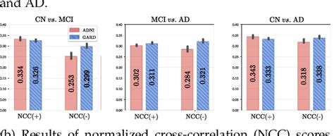 Figure 1 From A Quantitatively Interpretable Model For Alzheimers Disease Prediction Using Deep
