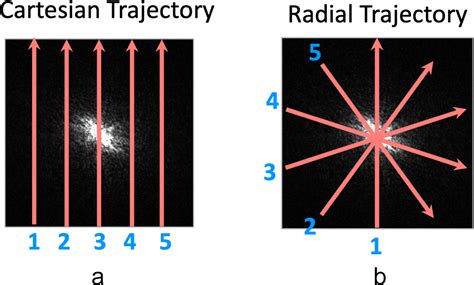 Golden‐angle Radial Mri Basics Advances And Applications Feng