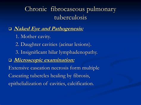 Ppt Tuberculosis Powerpoint Presentation Free Download Id1115184