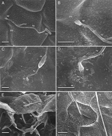Scanning Electron Micrographs Illustrating Infection Of Pleospora