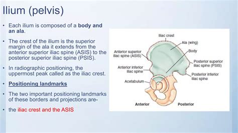 Radiographic Anatomy Of Femur And Pelvic Girdle Pptx