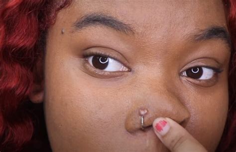 How To Get Rid Of Piercing Scars Effective Scar Minimization