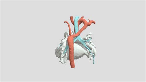Vsd Aortic Arch S0365 3d Model By Nch Advanced Projects Laboratory