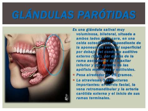 Parotiditis Doc