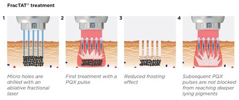 Ablative Laser Resurfacing Reskin Laser Clinic