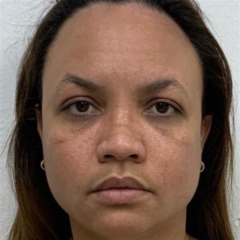 Opatra Believe Wellness Center