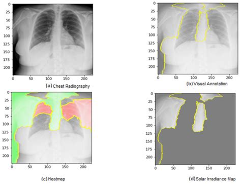 Explainable Artificial Intelligence Xai For Deep Learning Based