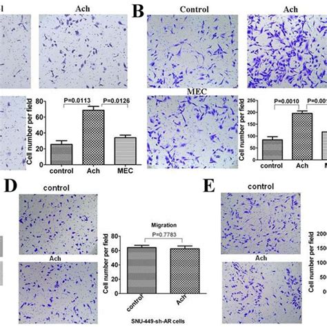 A B Transwell Cell Migration And Invasion Assays Showed The Effects