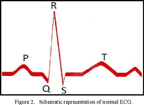 Figure 1 From Detection Of Obstructive Sleep Apnea Through Ecg Signal Features Semantic Scholar
