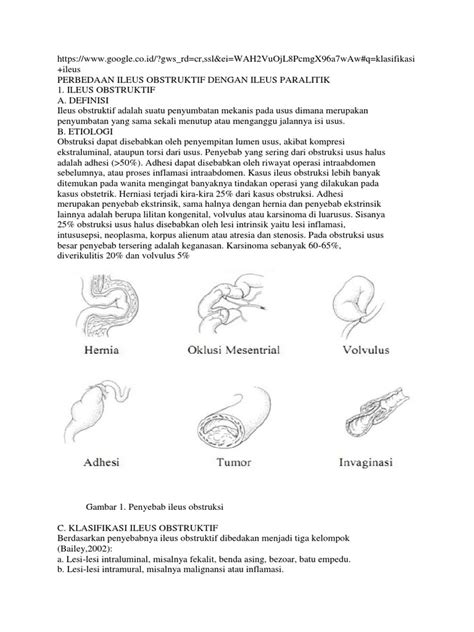Perbedaan Ileus Obstruktif Dengan Ileus Paralitik Pdf Sains