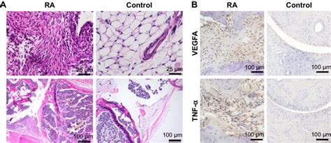 Histological Analysis A Hande Staining Shows Hyperplastic Synovium In