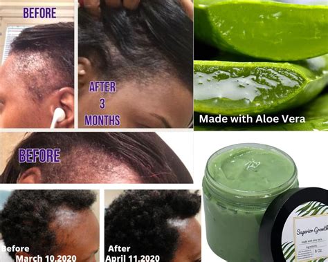 Superior Growth Grease All Natural Hair Greasealoe Vera Hair Grease
