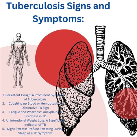 Tuberculosis Signs And Symptoms Identifying The Warning Indicators In 2023tb Haseeb Ahmad