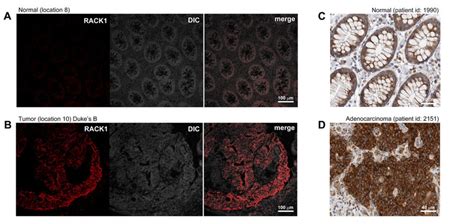 Indirect Immunofluorescence Analysis Of Differentially Expressed