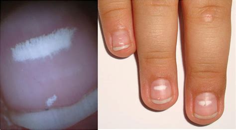 20134 24ungual Our Dermatology Online