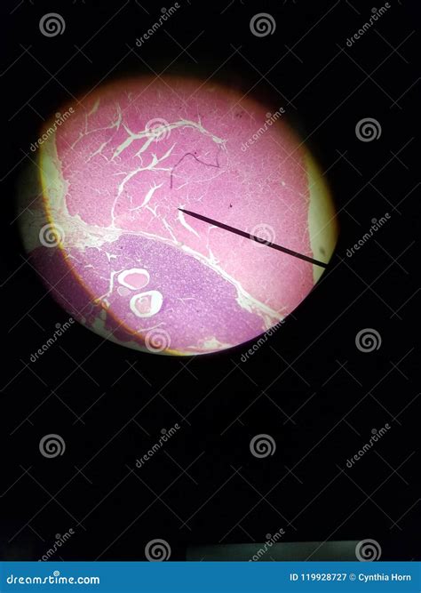 Thyroid Under Microscope Stock Image Image Of 400x 119928727