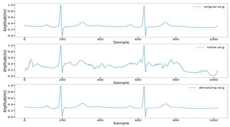 Ecg Signal Denoising Method Based On Disentangled Autoencoder