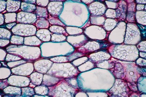 Cinnamon Bark Microscope