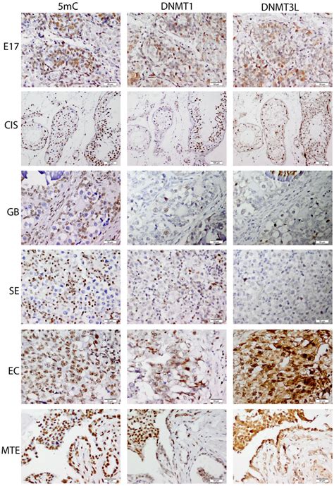 Immunohistochemical Staining For 5mc Left Column Dnmt1 Middle