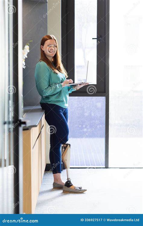 Using Laptop Woman With Prosthetic Leg Standing In Modern Office