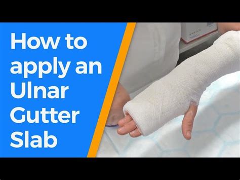 Ulnar Gutter Cast