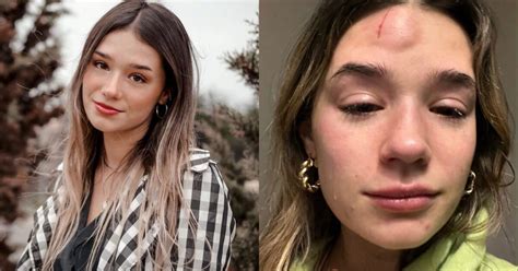 Podría Haber Muerto Alessia Traverso Fue Duramente Criticada Tras Peligroso Reto Viral Sabescl