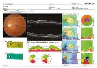 Normal Abnormal Oct Scan