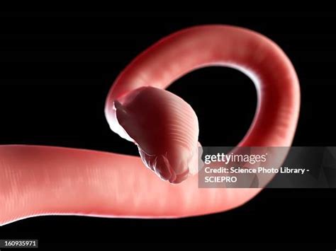 Roundworm In Humans